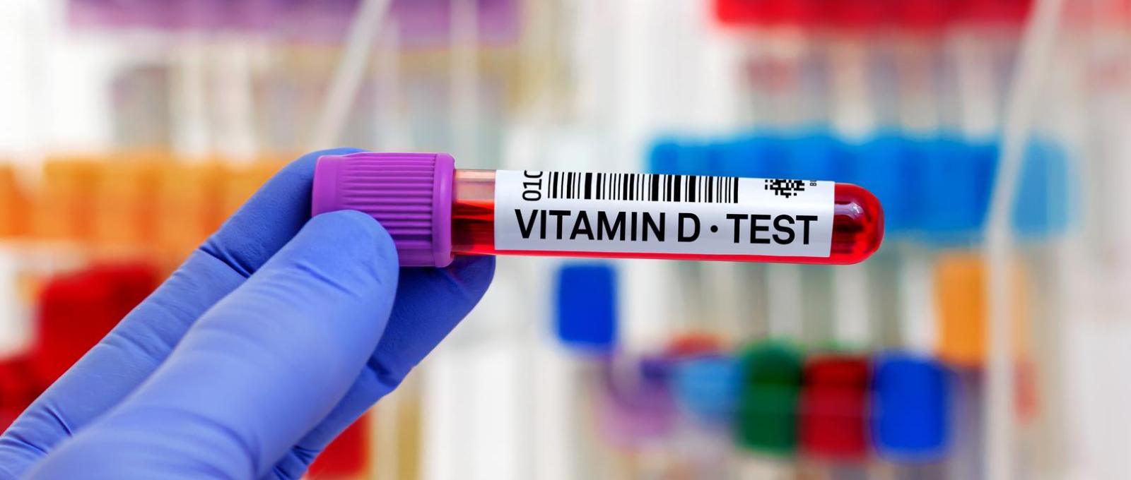 Uočite ih na vrijeme: Ovo su znakovi da vam nedostaje vitamina D - Dnevnik.in